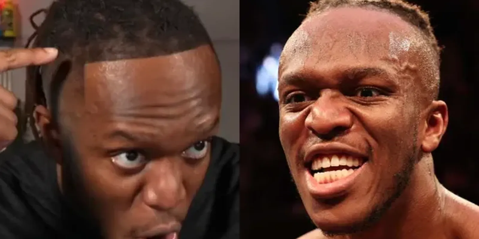 Why Is KSI s Hairline Receding And How To Regrow Hair System